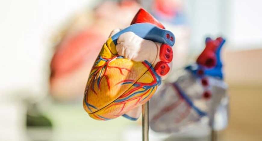CSI initiates KAIZEN clinical study of Diamondback 360 system in Japan ...