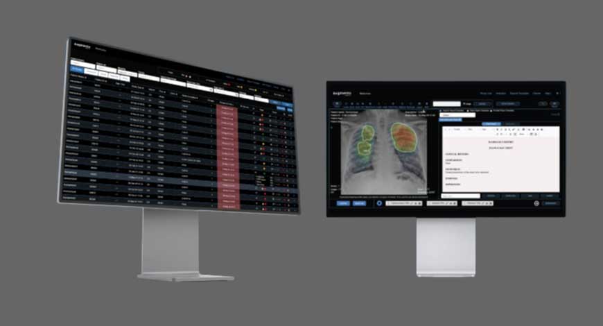 Augmento gets FDA clearance – Medical Buyer